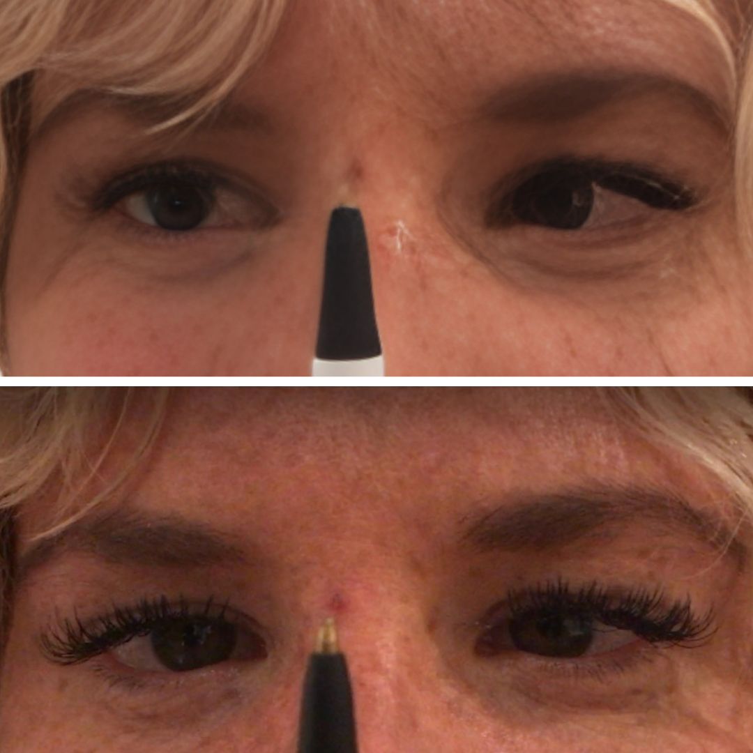NeuroVision: Eye Exercises to Improve Posture – Posturepro